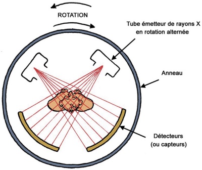 Comment ça marche : Le scanner et l'IRM | Espace des sciences